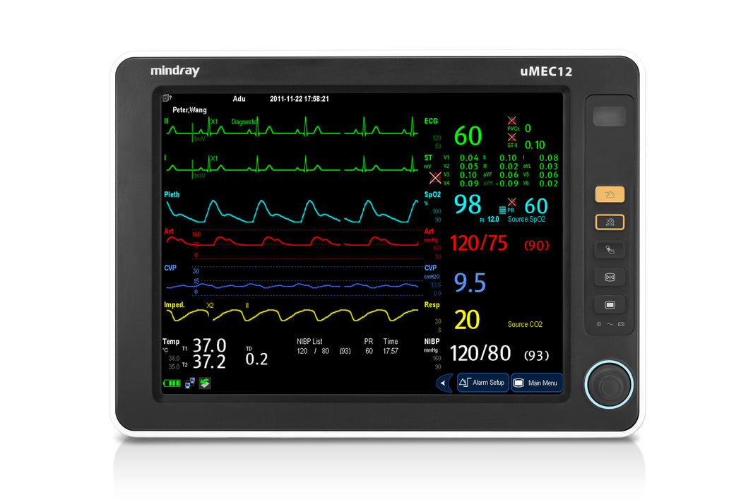 Monitores – AR Biomedical Solutions | Venta y de Equipo Médico en México